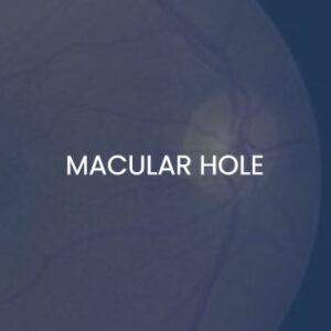 Ophthalmologists Near Me in Connecticut | Serving 6 Locations