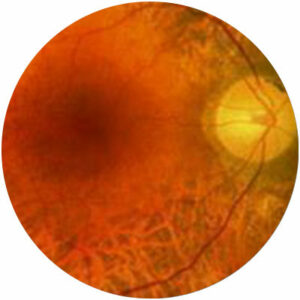 Ophthalmology Services at Connecticut Retina Consultants