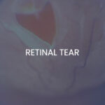 Retina Specialist Near Me in Connecticut | Convenient Locations