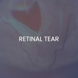 Retina Specialist Near Me in Connecticut | Convenient Locations