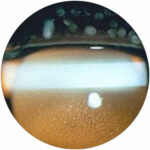 Retina Specialist Near Me in Connecticut | Convenient Locations