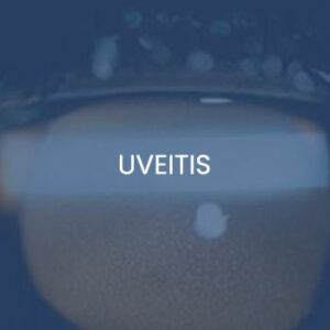 Ophthalmologists Near Me in Connecticut | Serving 6 Locations