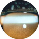 Retina Specialist Near Me in Connecticut | Convenient Locations